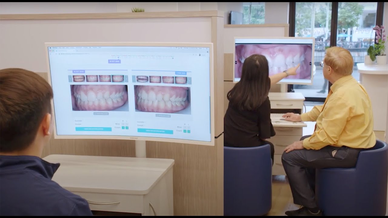 5 Things to Know Before Straightening Your Teeth